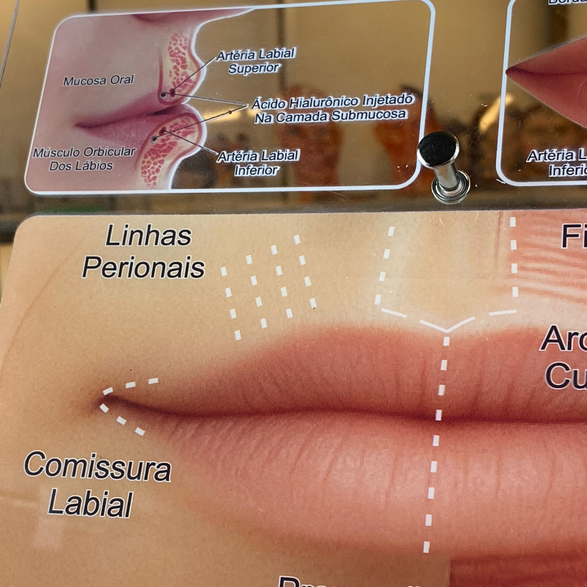 Anatomia e Preenchimento Labial - Quadro de Marcação - Macromodelo ...
